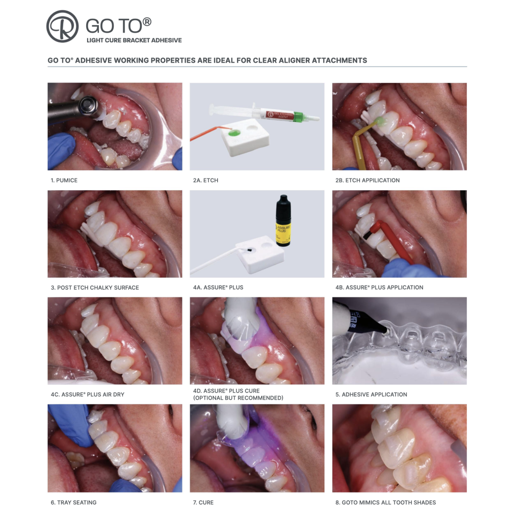 GOTO™ Light Cure Bracket Adhesive